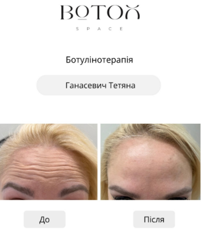 «Botox Space» Ціни, Відгуки - косметології у Львові | Телефон, онлайн ...