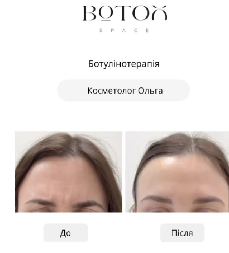«Botox Space» Ціни, Відгуки - косметології у Львові | Телефон, онлайн ...